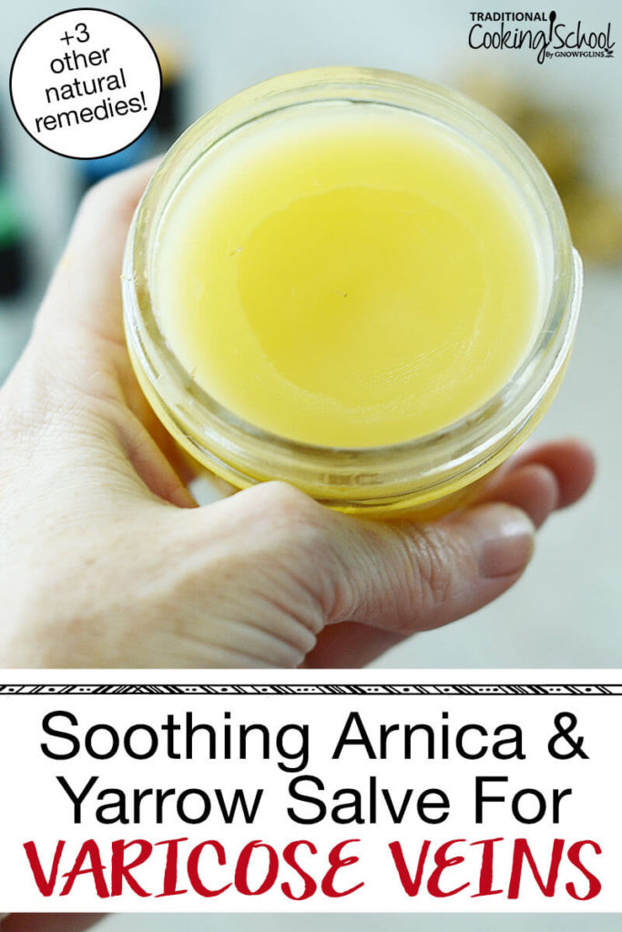Varicose Veins Treatment: Soothing Arnica & Yarrow Salve
